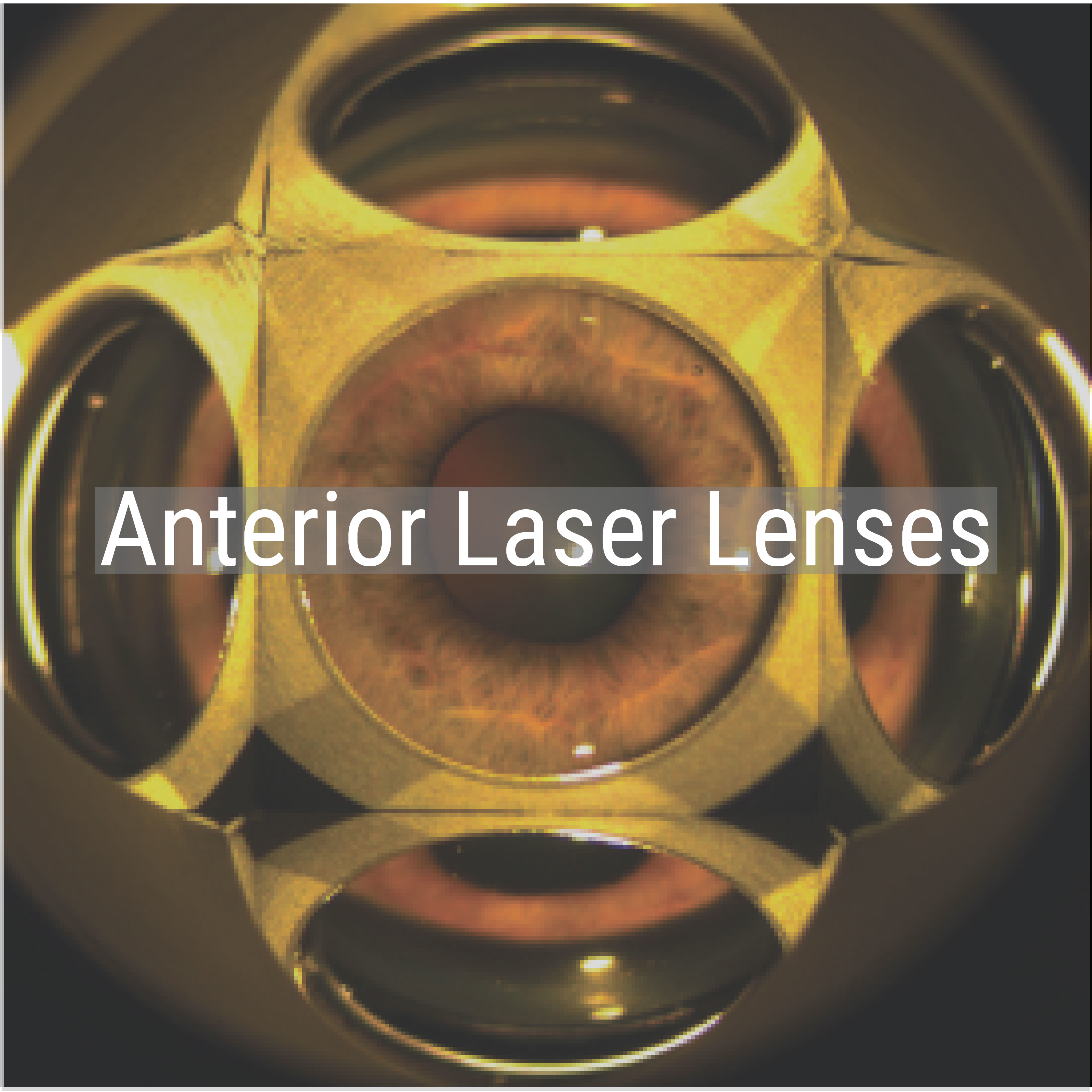 Specialty Laser Lenses for Retinal & Glaucoma