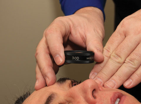 Buy Volk 30D BIO Lens - Volk Optical