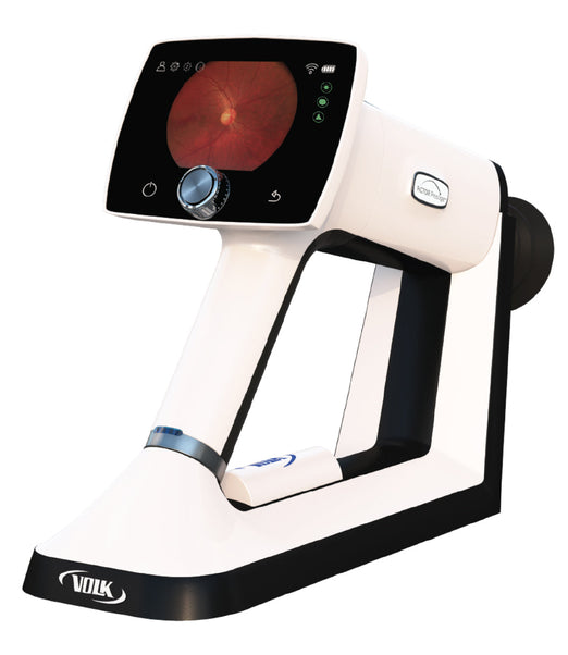 Volk Selective Laser Trabeculoplasty (SLT) Lens