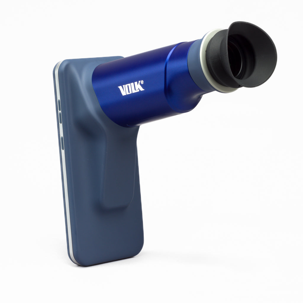 Viva Non-Mydriatic Handheld Retinal Camera – Volk Optical