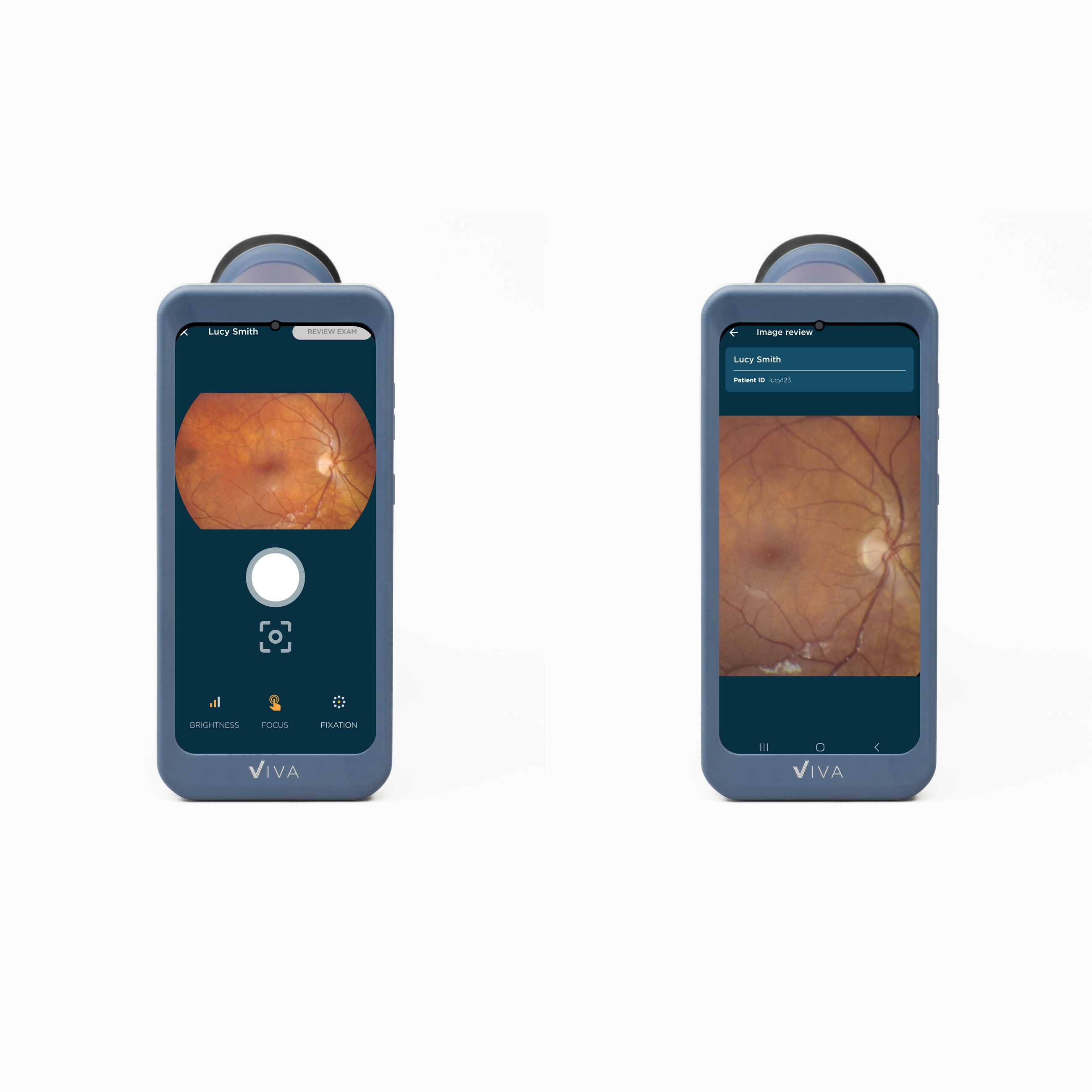 VIVA Portable Fundus Camera | Fast Retinal Imaging