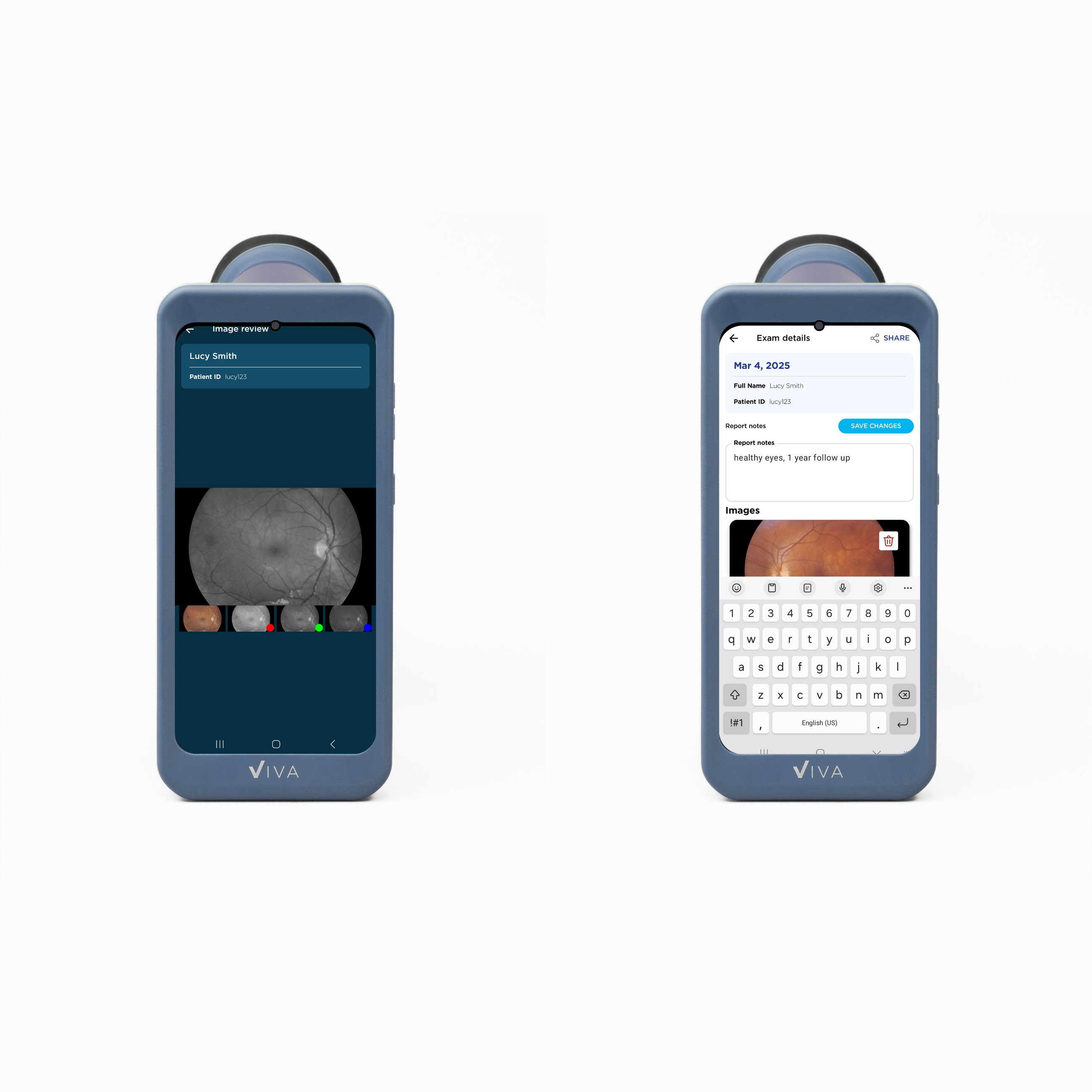 VIVA Portable Fundus Camera | Fast Retinal Imaging