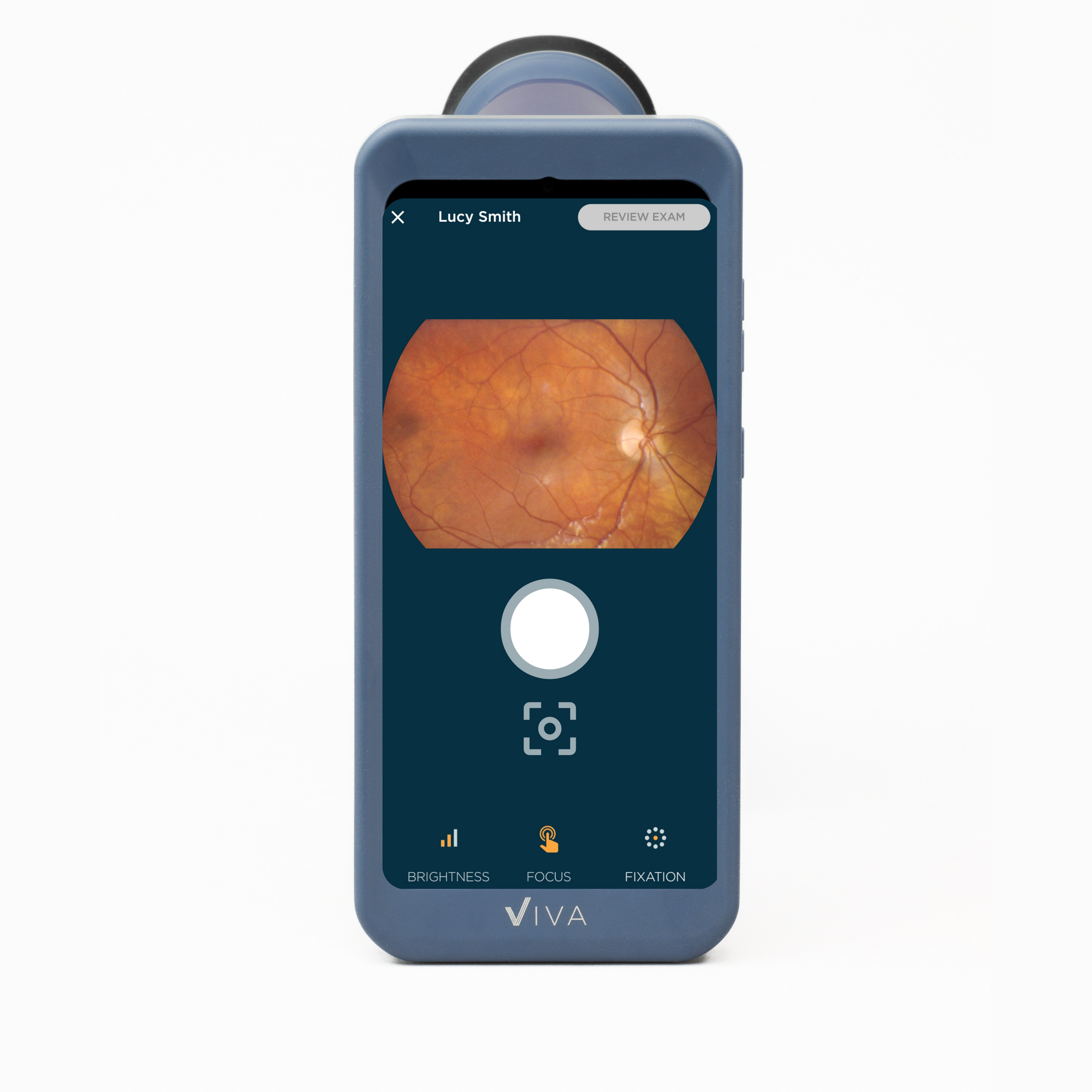 VIVA Portable Fundus Camera | Fast Retinal Imaging