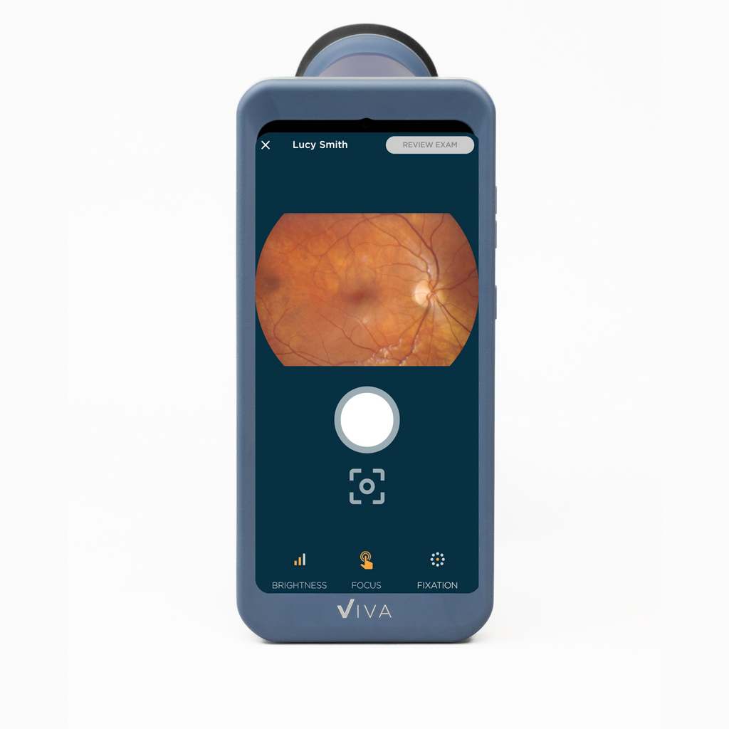 Viva Non-Mydriatic Handheld Retinal Camera – Volk Optical