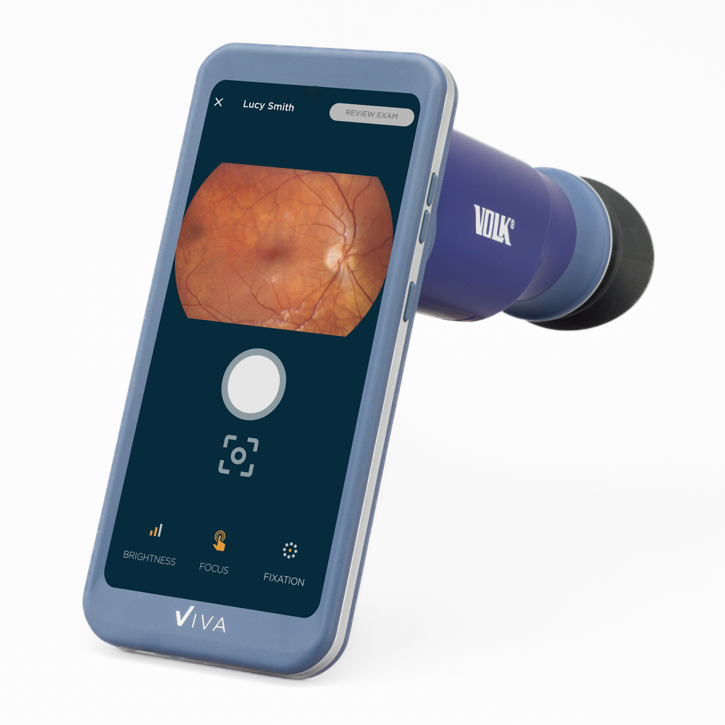 Viva Non-Mydriatic Handheld Retinal Camera – Volk Optical
